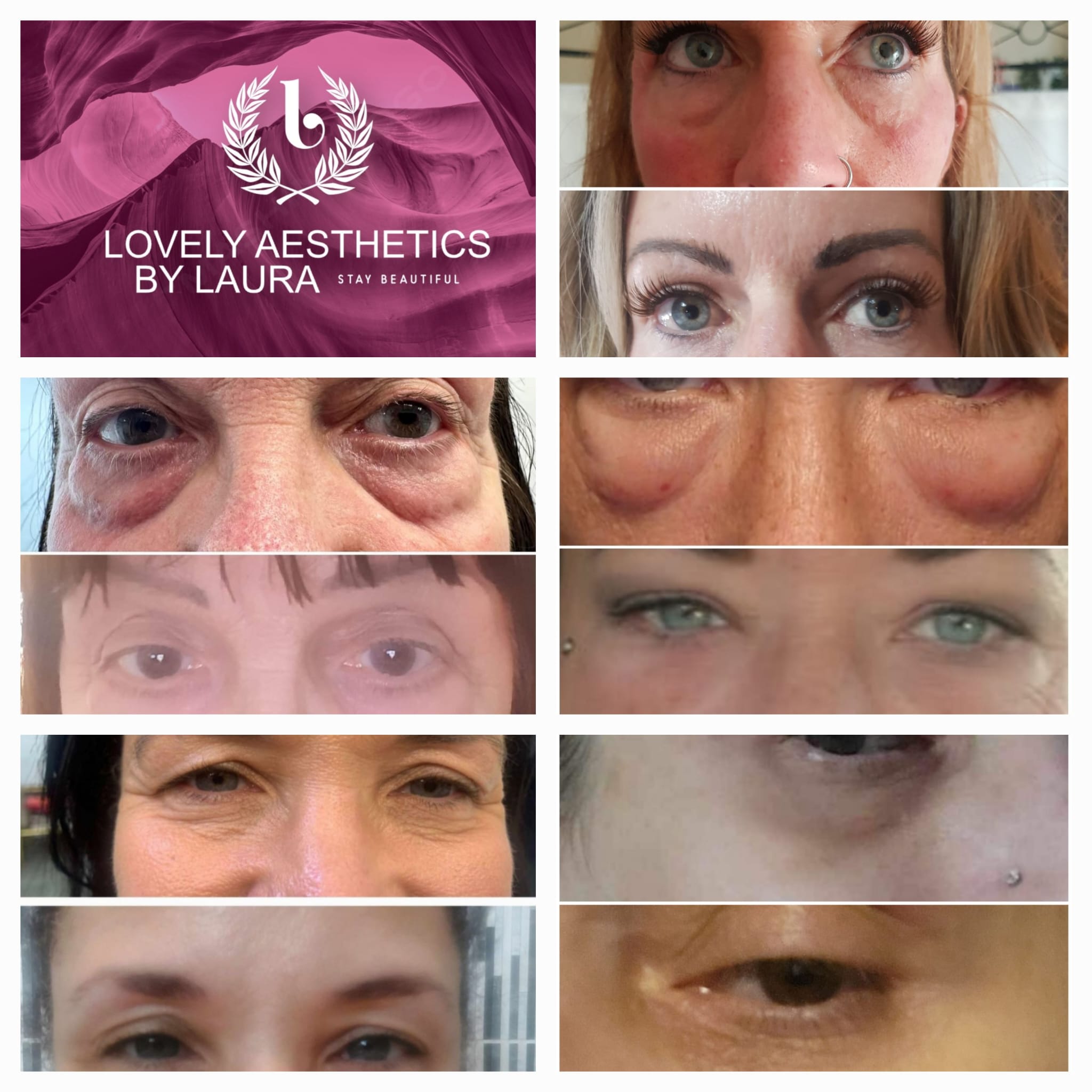 DERMA 2.0 - Lovely Aesthetics